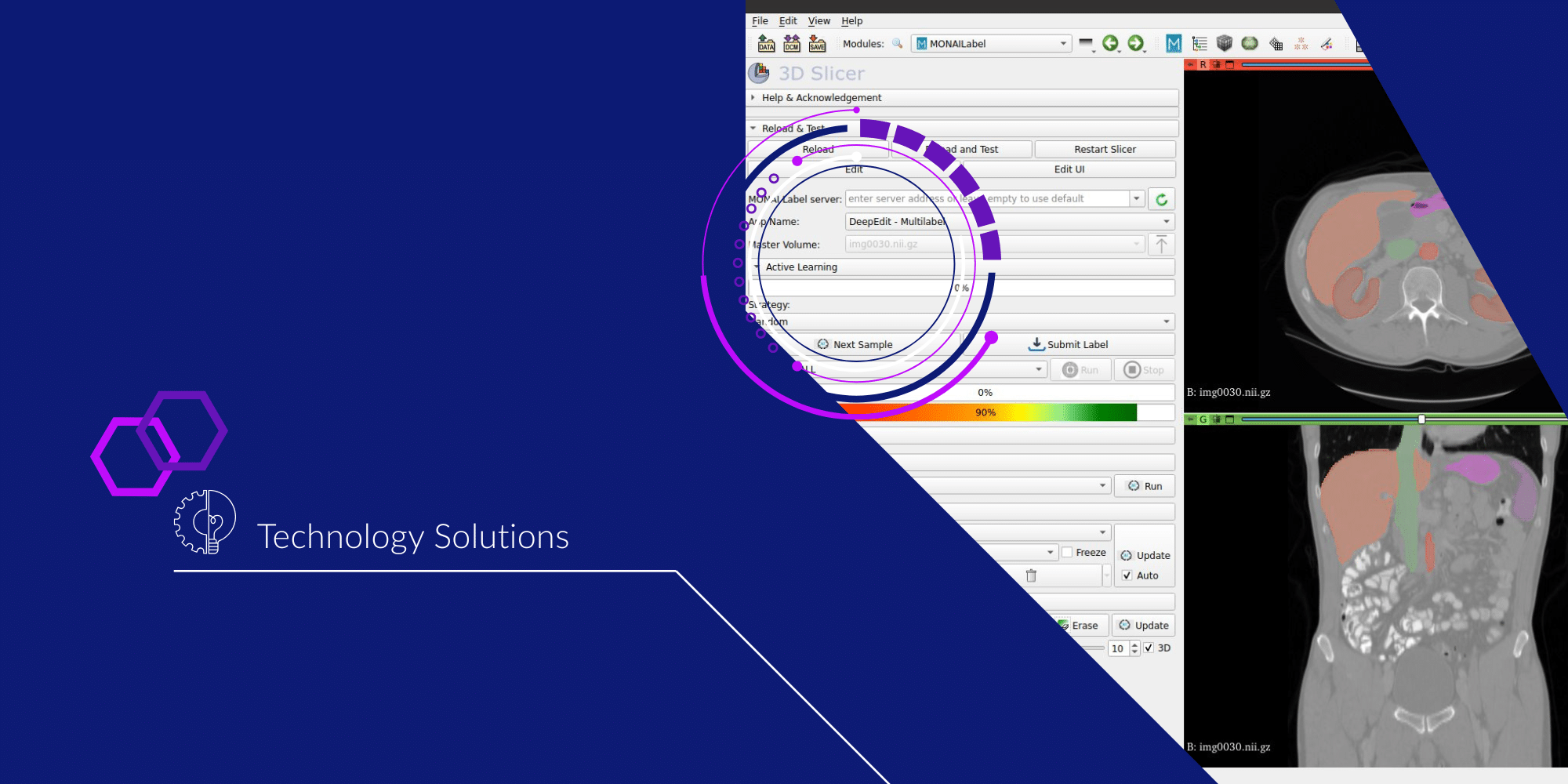 UNSW AI in Medical Imaging - MONAI - Intersect